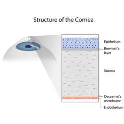 Corneal Conditions | Ophthalmic Consultants, NY